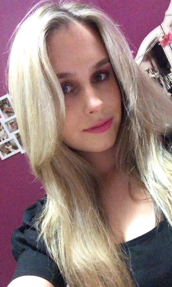 สาวผู้รอดชีวิต โดนภูเขาไฟระเบิด ร่างกายเสียหาย 70% ฮึดสู้กลับมาอย่าง ...