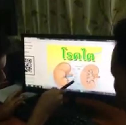 คุณหมอ Mad Doc แร็พโรคเบาหวาน ฟังแล้วโยกหัวตามเลยครับ